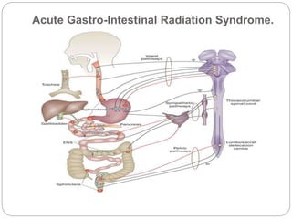 Acute Radiation Gastro-Intestinal syndrome. | PPTX