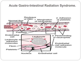 Acute Radiation Gastro-Intestinal syndrome. | PPTX