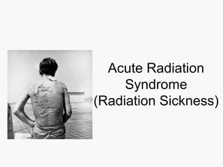 Acute radiation syndrome | PPT