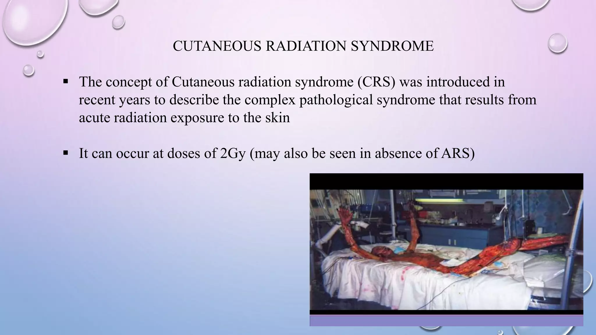 ACUTE RADIATION SYNDROME.pptx