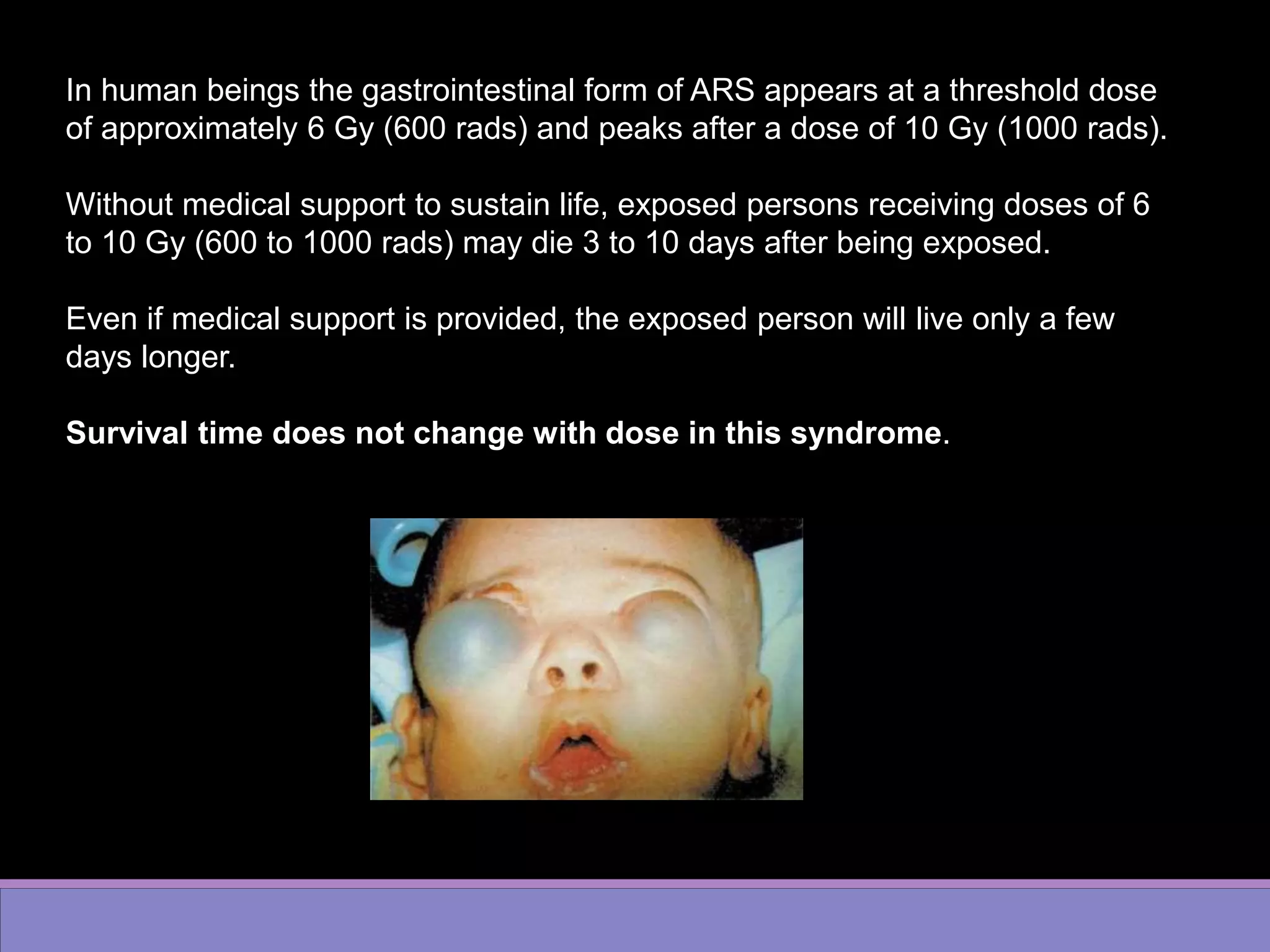 Acute radiation syndrome | PPTX | Cancer | Diseases and Conditions