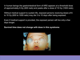 Acute radiation syndrome | PPTX