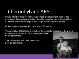 Chernobyl Acute Radiation Syndrome
