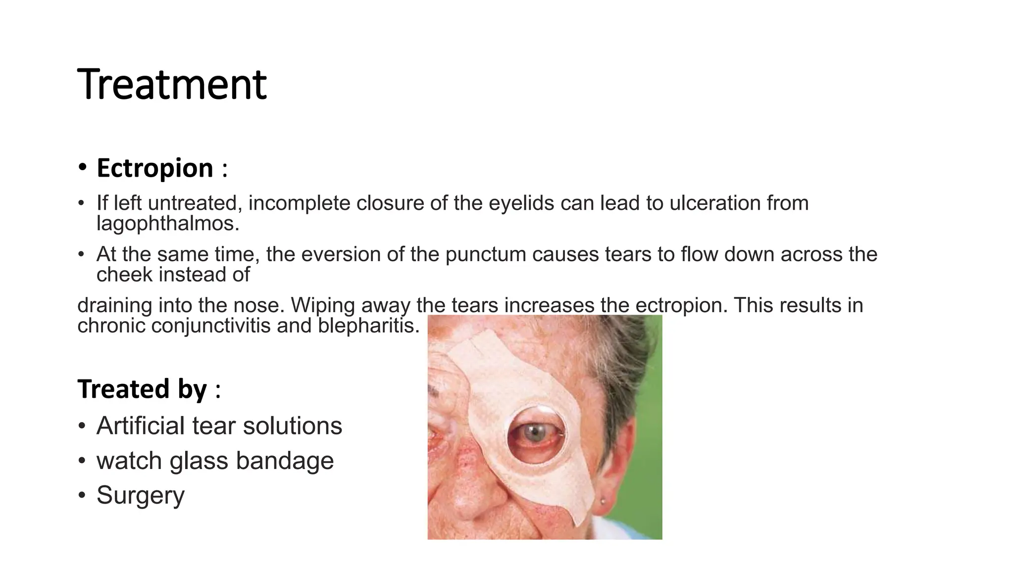 Approach to Acute Red Eye and its DDX.pptx