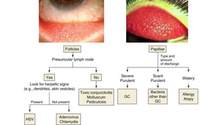 Approach to Acute Red Eye and its DDX.pptx