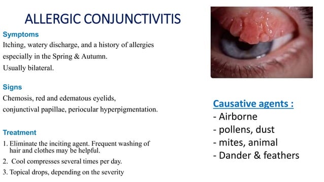 Approach to Acute Red Eye and its DDX.pptx | Eye and Vision Conditions ...