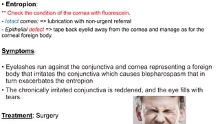 Approach to Acute Red Eye and its DDX.pptx