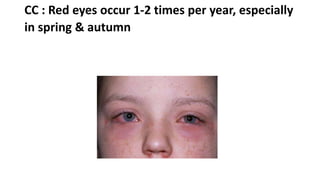 Approach to Acute Red Eye and its DDX.pptx