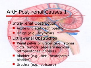 Acute renal failure | PPT
