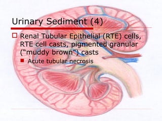 Acute renal failure | PPT