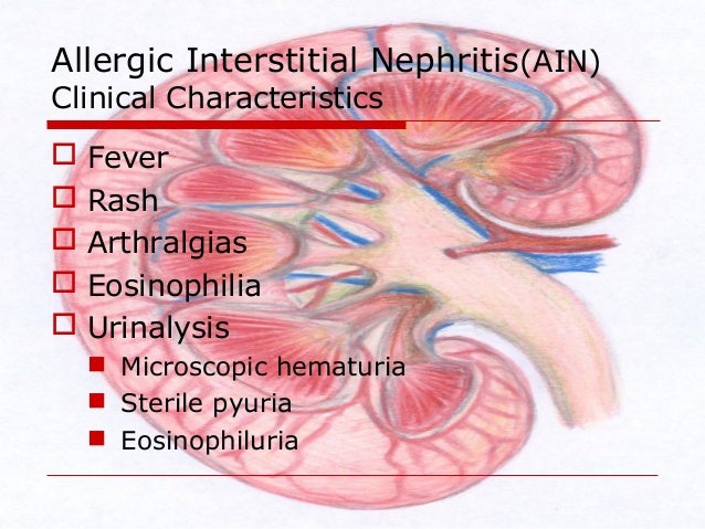 Acute renal failure
