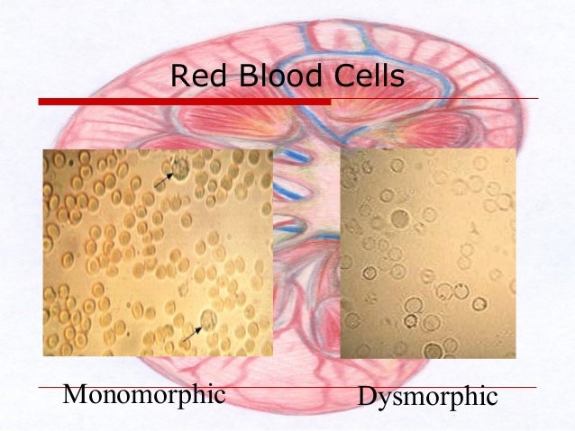 Acute renal failure