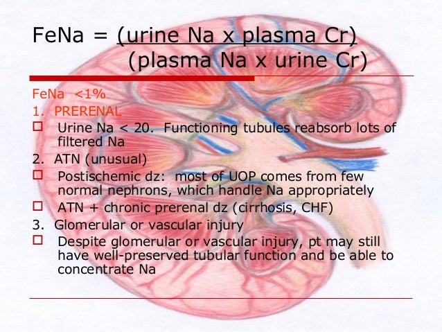Acute renal failure
