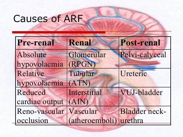 Intrarenal Acute Kidney Failure