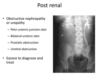 Acute renal failure | PPTX