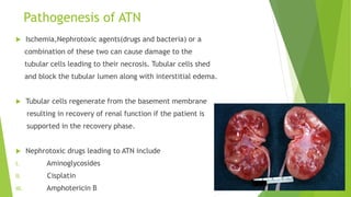 Acute renal failure | PPT