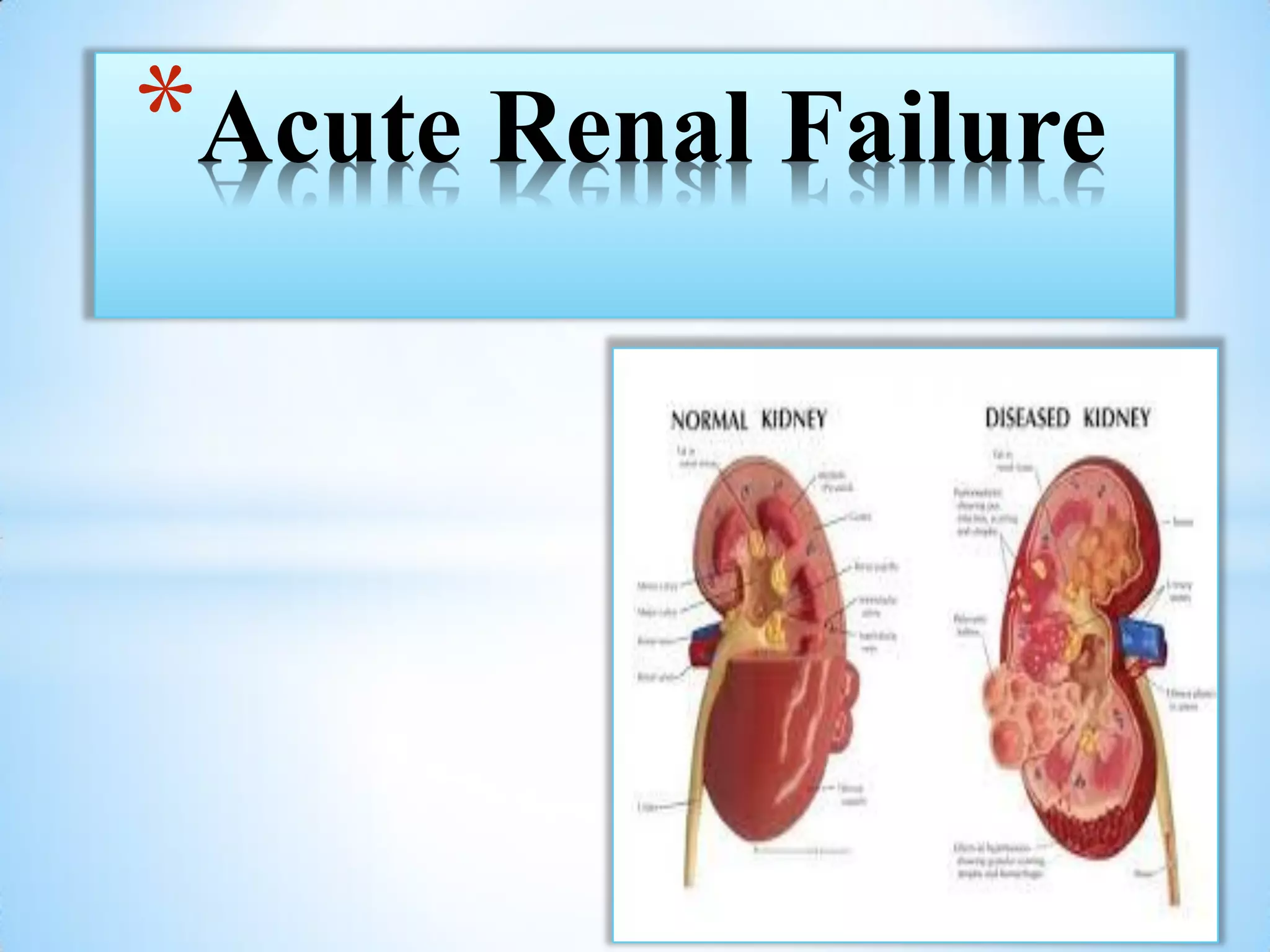 Acute Renal Failure.pdf