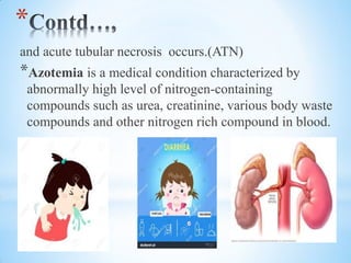 Acute Renal Failure.pdf