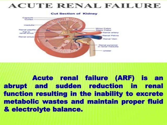 Acute renal failure.pptx