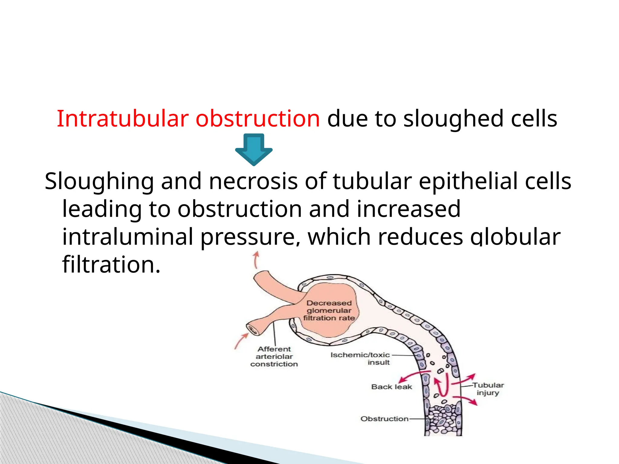ACUTE RENAL FAILURE.pptx for nursing students | PPTX