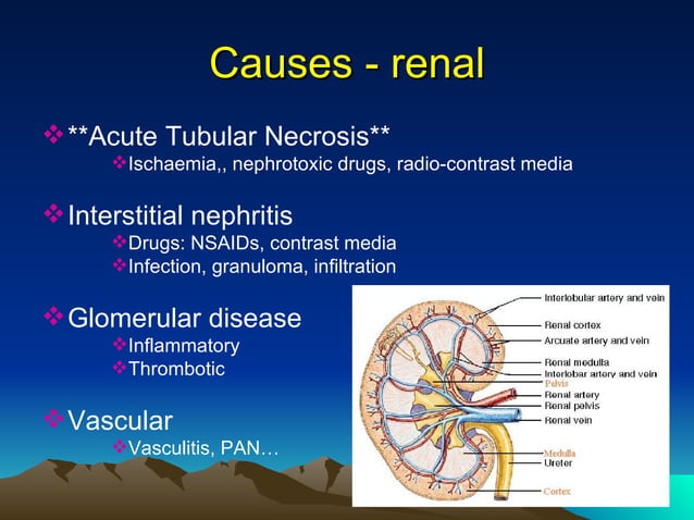 Acute Renal Failure | PPT | Diseases and Conditions | Medical Health