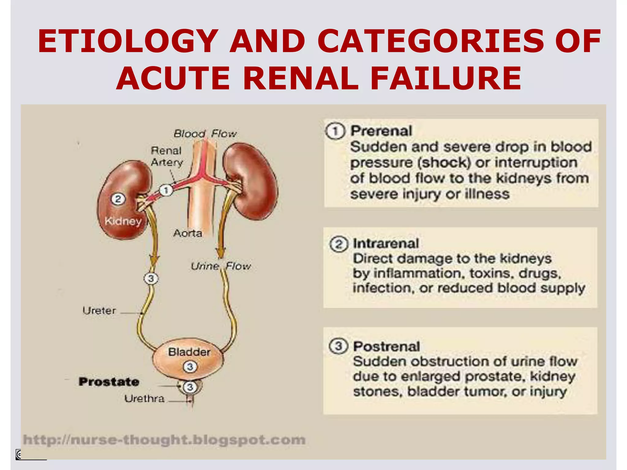 Acute renal failure and chronic renal failure | PDF