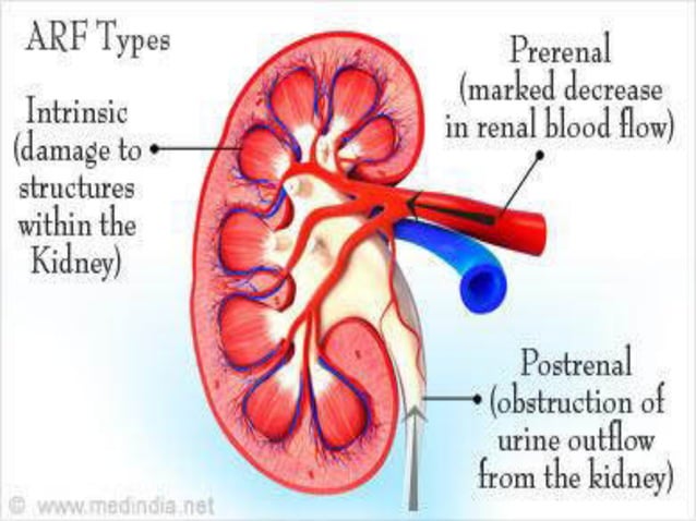 Acute renal failure and chronic renal failure | PDF | Blood Disorders | Diseases and Conditions