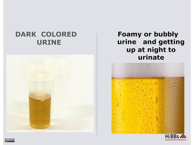 Acute renal failure and chronic renal failure | PDF | Blood Disorders ...