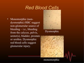 Acute renal failure | PPT