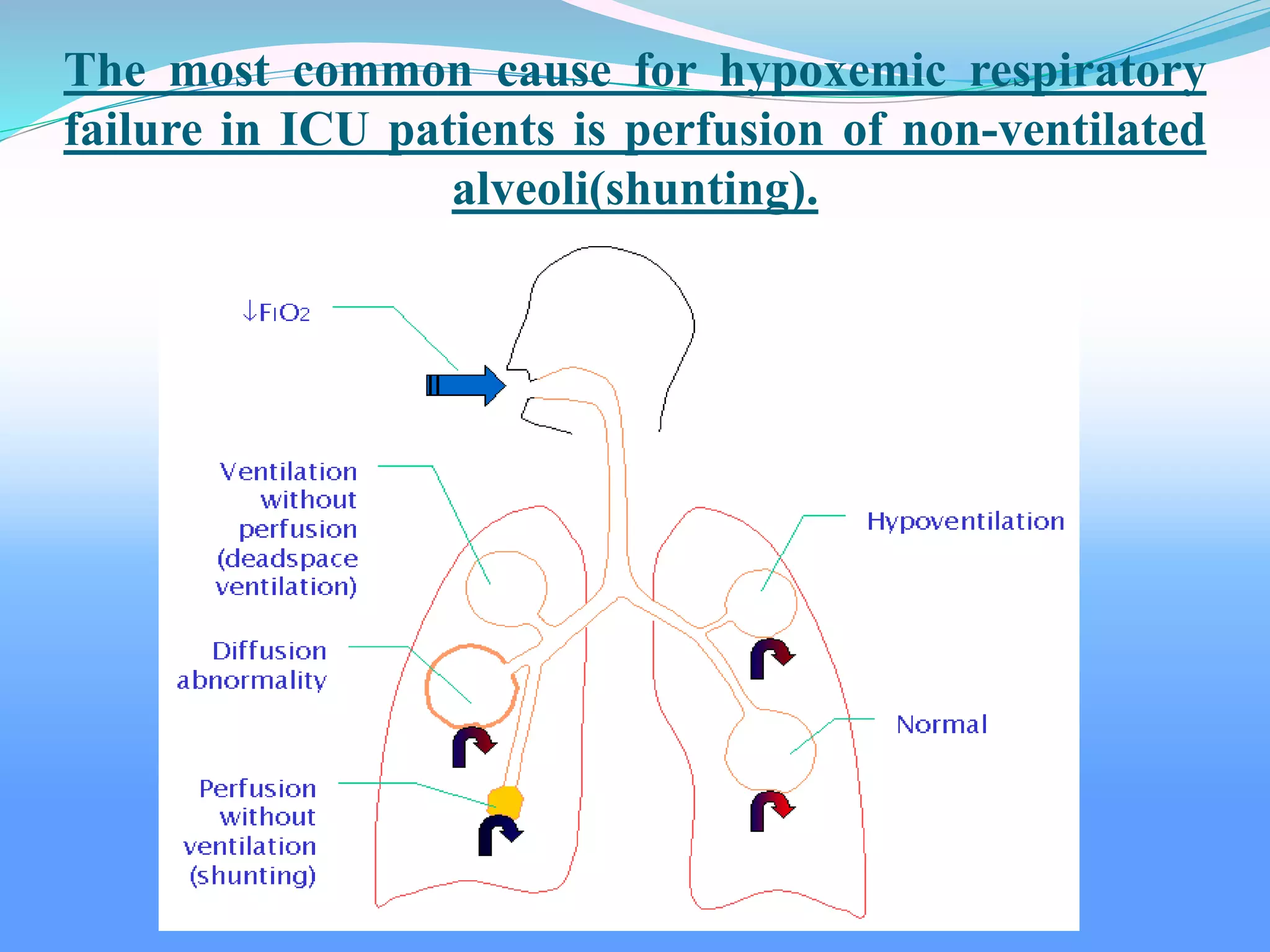 Acute respiratory failure ppt | PPTX