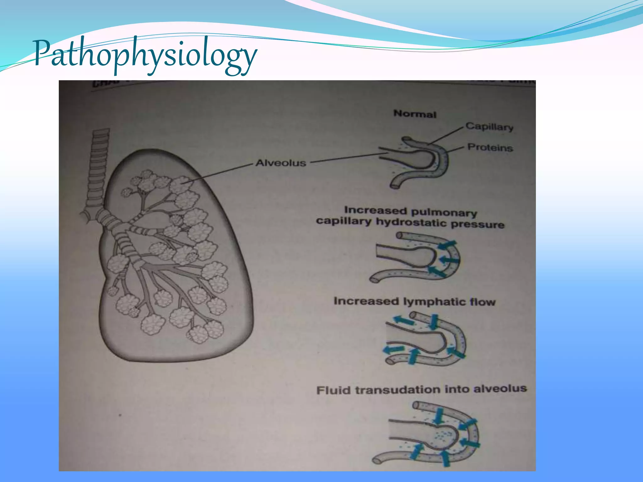 Acute respiratory failure ppt | PPTX
