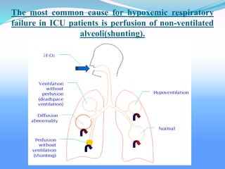 Acute respiratory failure ppt | PPTX
