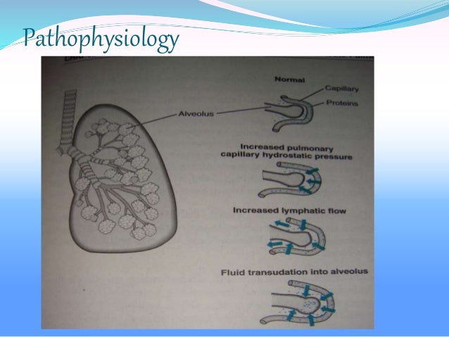 Acute respiratory failure ppt