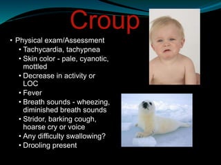 Acute_respiratory_diseses_in_Children___Croup.pptx