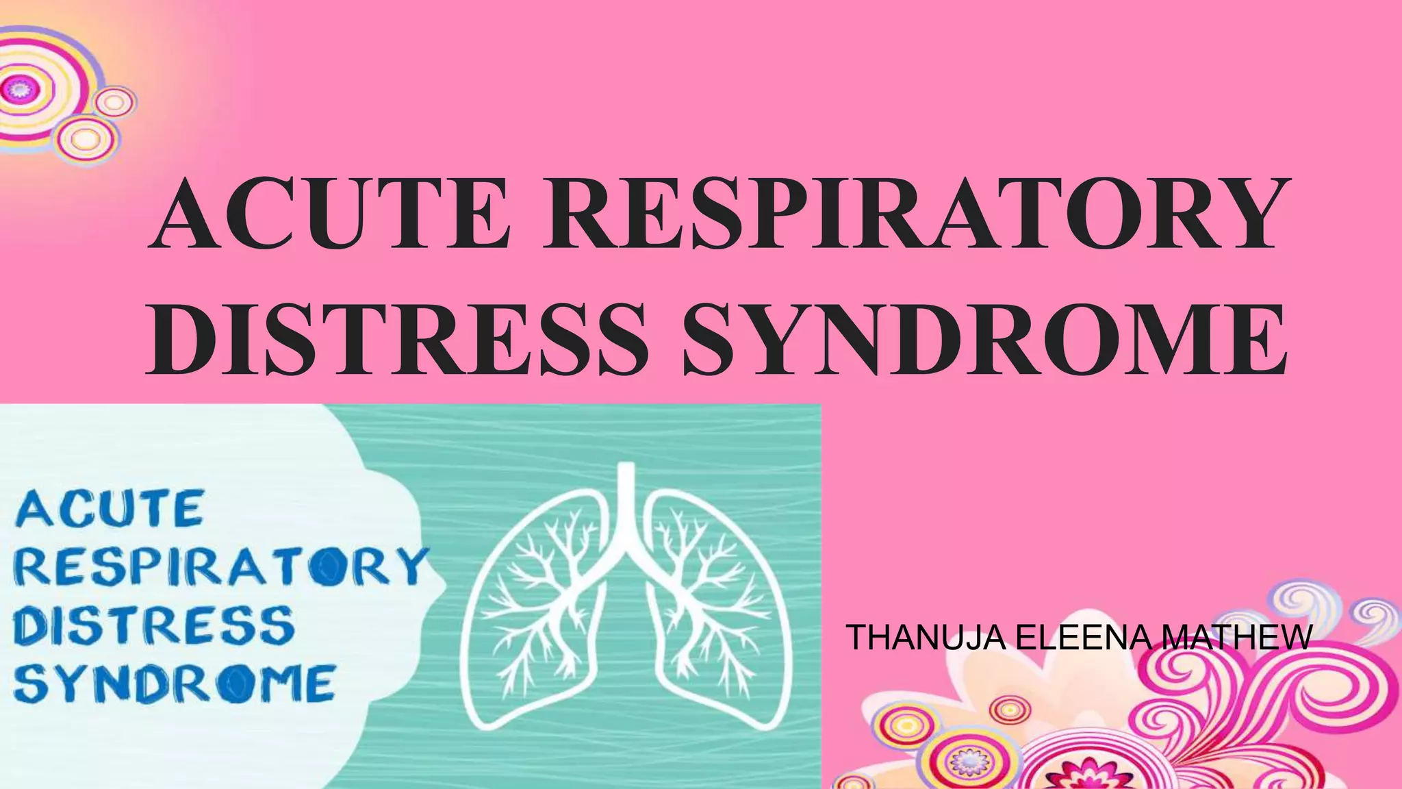 Acute respiratory distress syndrome | PPT