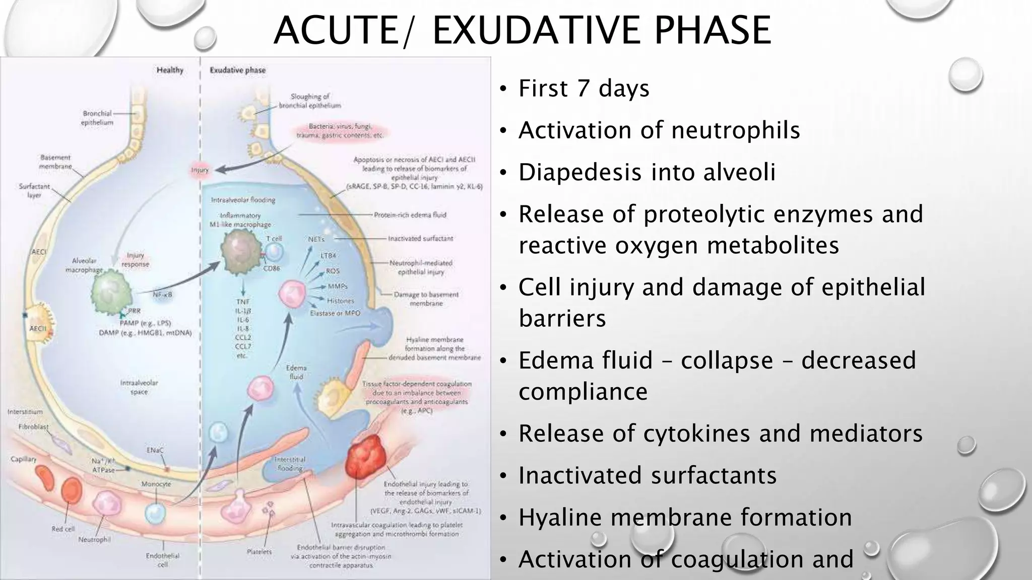 Acute Respiratory Distress Syndrome | PPTX