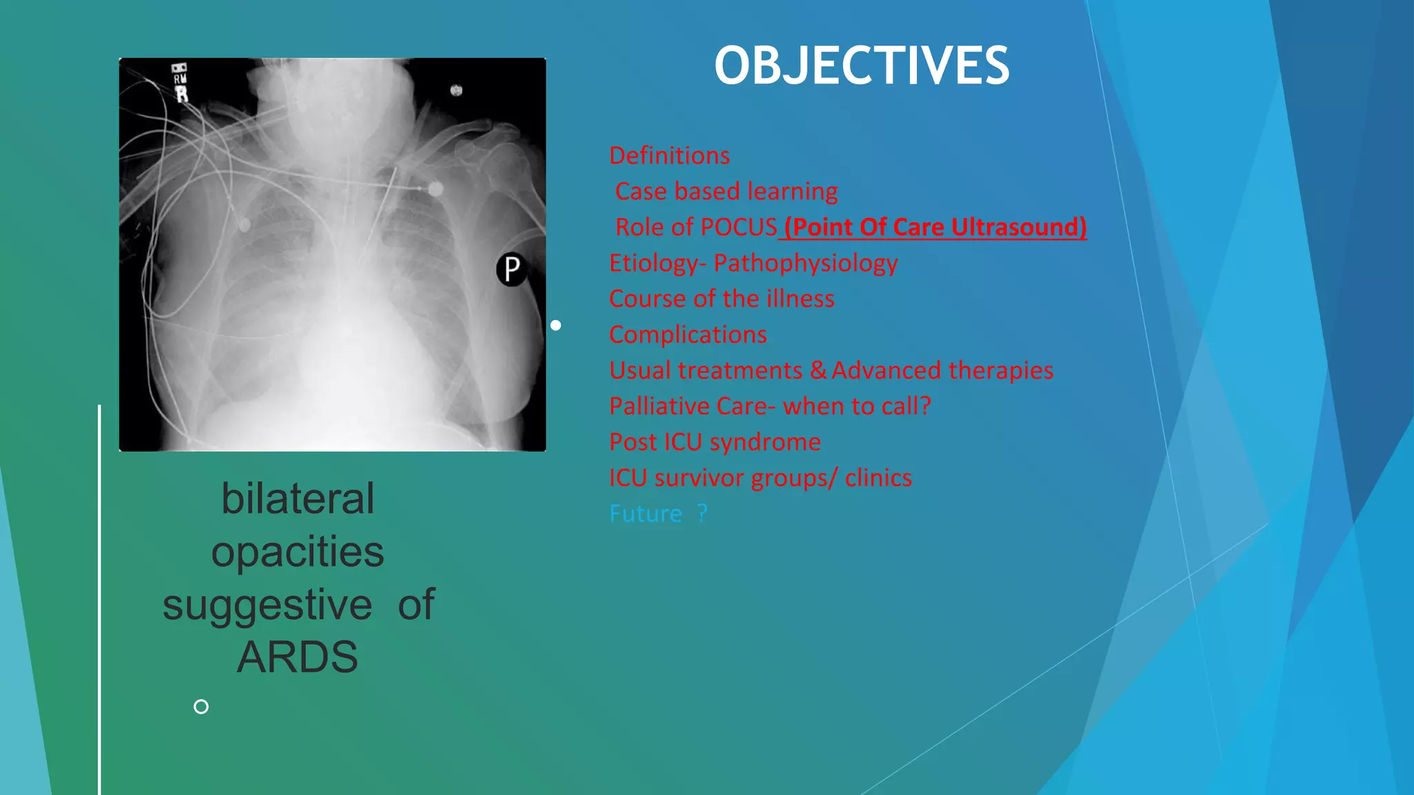 Acute Respiratory Distress Syndrome. ppt 2023 Siva P Sivakumar.pptx
