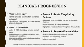 Acute Respiratory Distress Syndrome.pptx