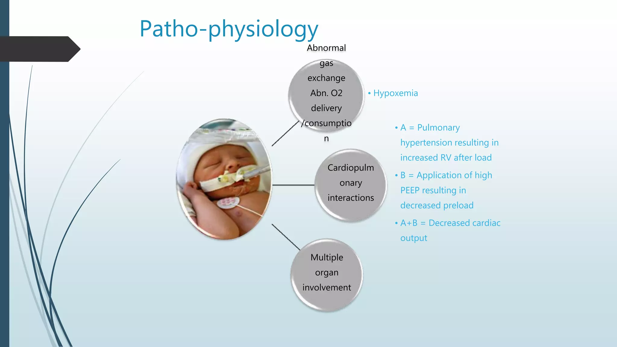 Acute Respiratory Distress Syndrome | PPTX