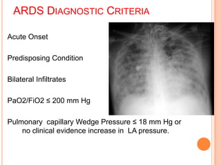Acute respiratory distress syndrome (ards) | PPTX | Lung and ...
