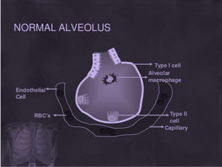 Acute respiratory distress syndrome (ARDS) | PPTX