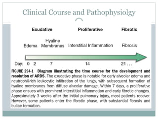 Acute respiratory distress syndrome(ARDS) | PPT