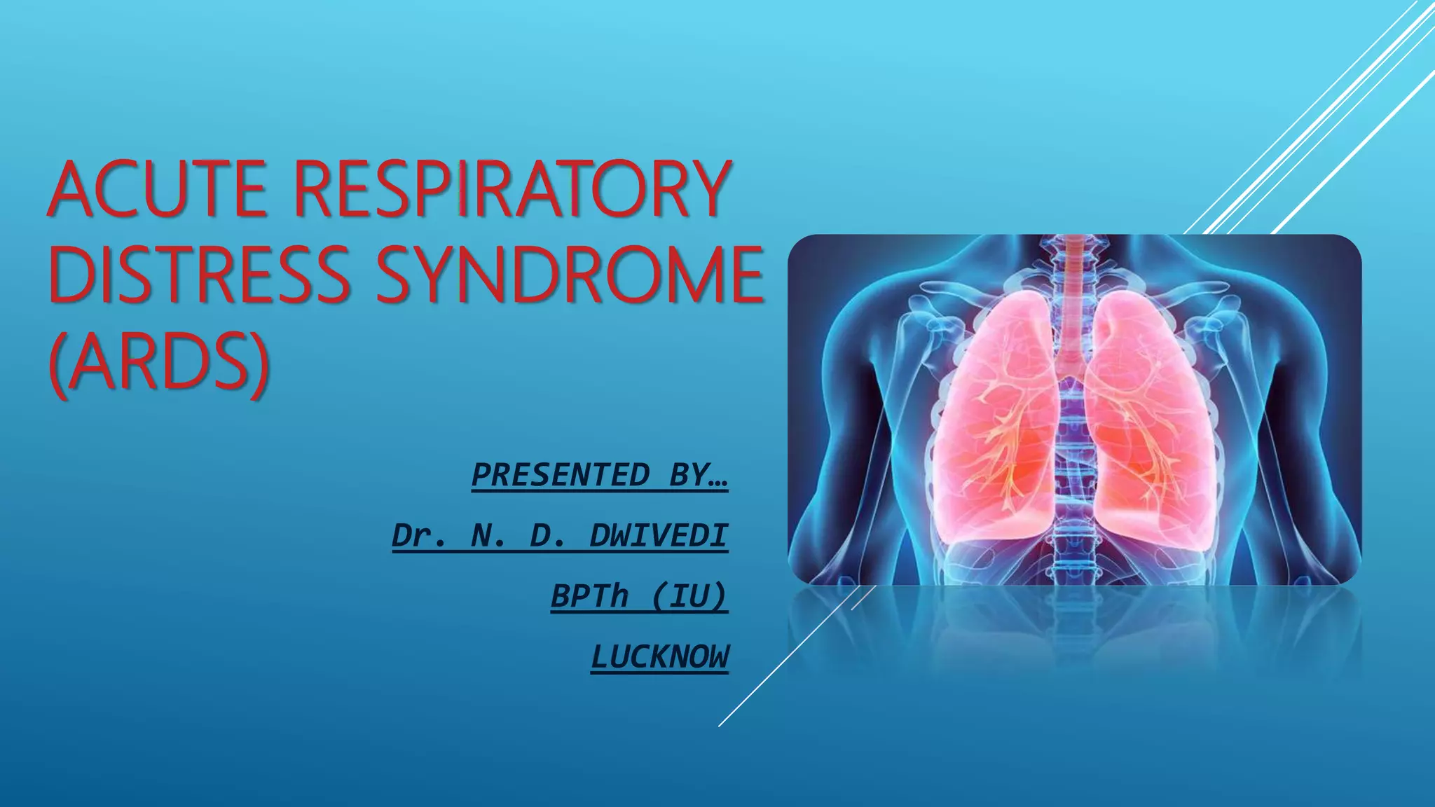 Acute Respiratory Distress Syndrome | PPTX