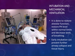Acute Respiratory Failure | PDF