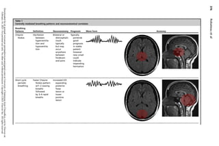 Acute Respiratory Failure in Severe Acute Brain Injury.pdf