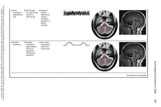 Acute Respiratory Failure in Severe Acute Brain Injury.pdf