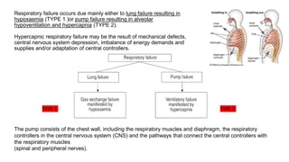 Acute Respiratory Failure PPT.pptx