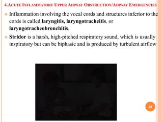 Acute Respiratory Infection (ARI) In Children ALL.pptx