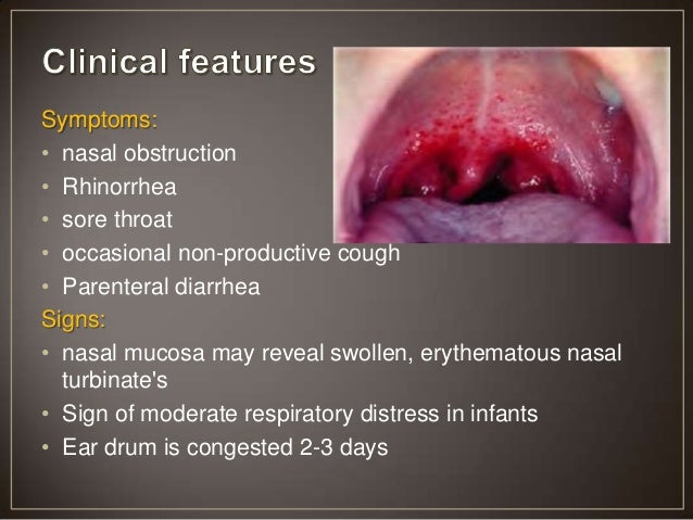 Acute respiratory infections in children