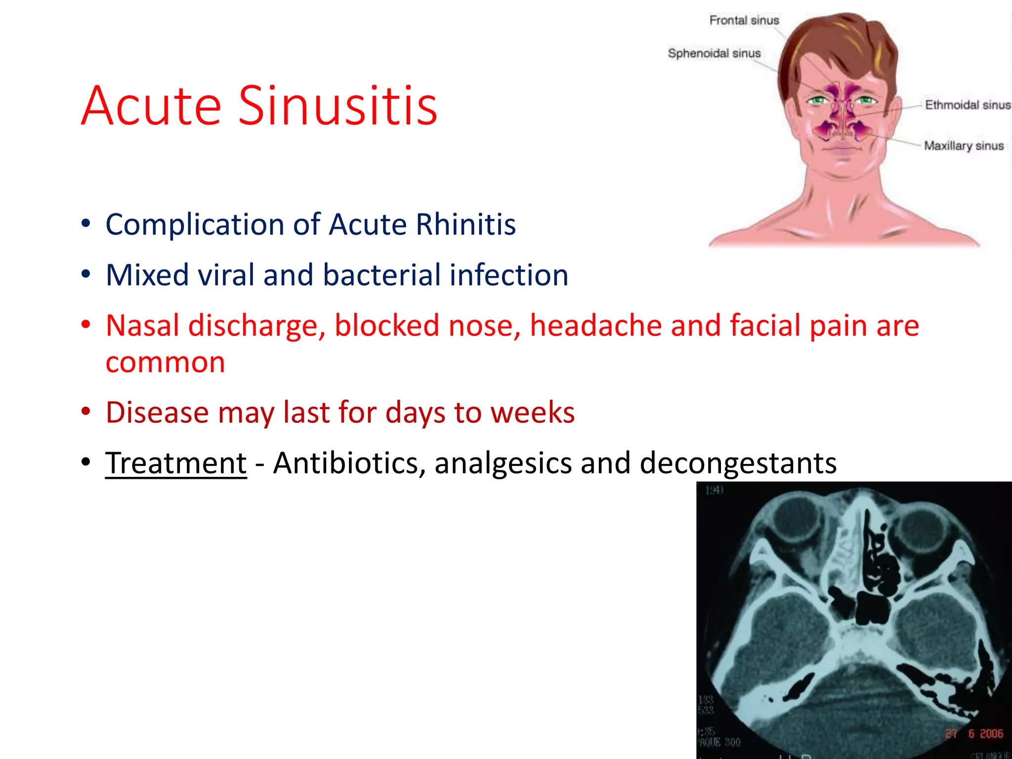 Acute respiratory infections 2021 | PPT